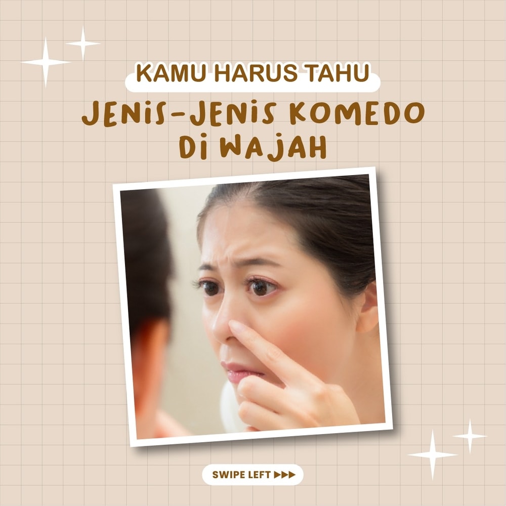 Jenis-Jenis Komedo di Wajah
