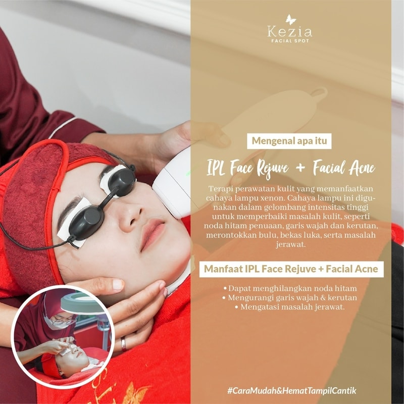 IPL Face Rejuve + Facial Acne