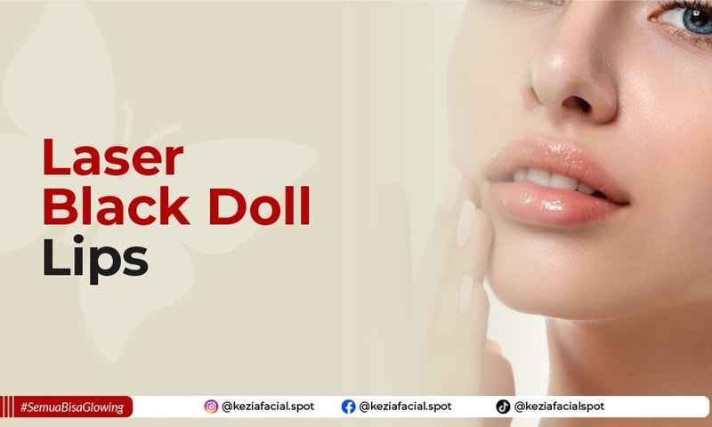 MENGENAL TREATMENT LASER BLACK DOLL DAN MANFAATNYA
